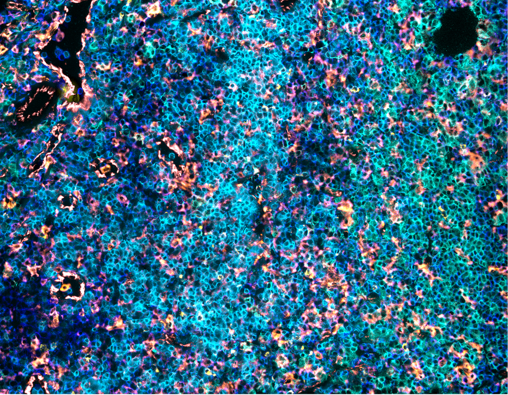 GOSH reveals first research image competition winner | Great Ormond ...